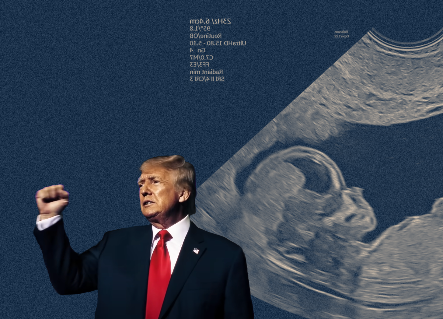 8 Pro-Life Actions President Trump Took In His First Week - SBA Pro ...